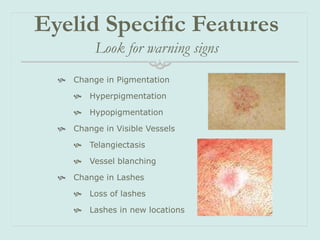 Eyelid skin-cancer-update-website | PPT