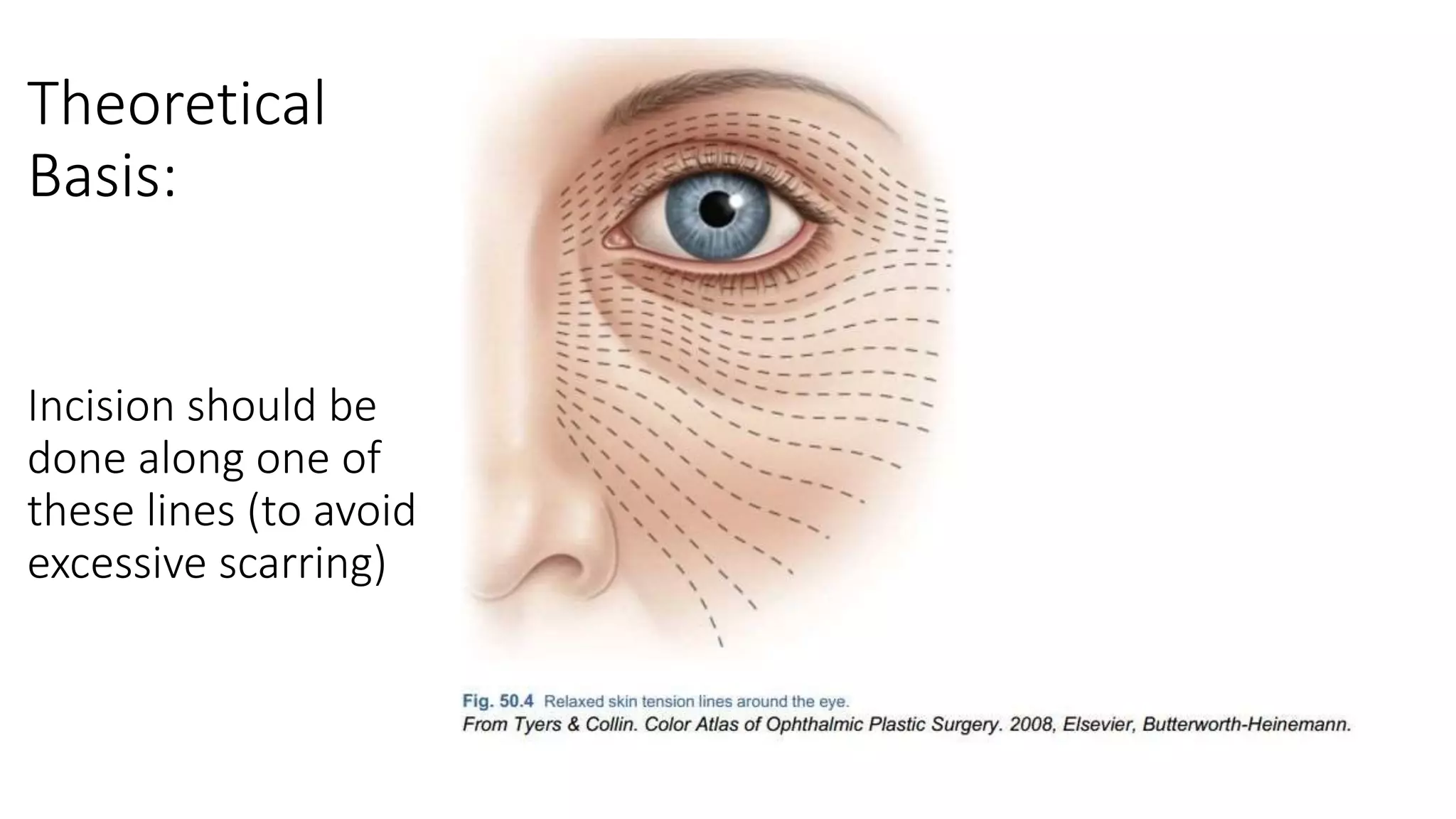 Eyelid abscess drainage | PPTX