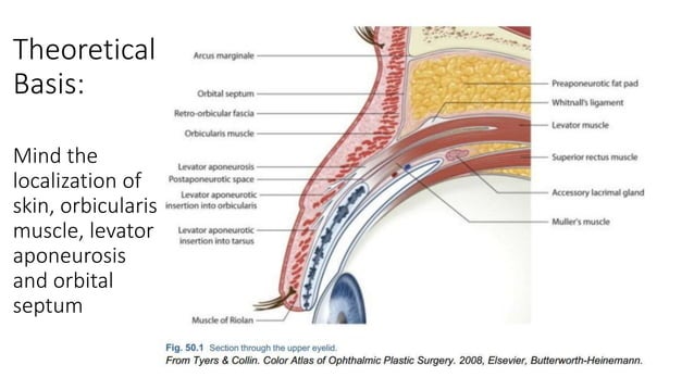 Eyelid abscess drainage | PPTX