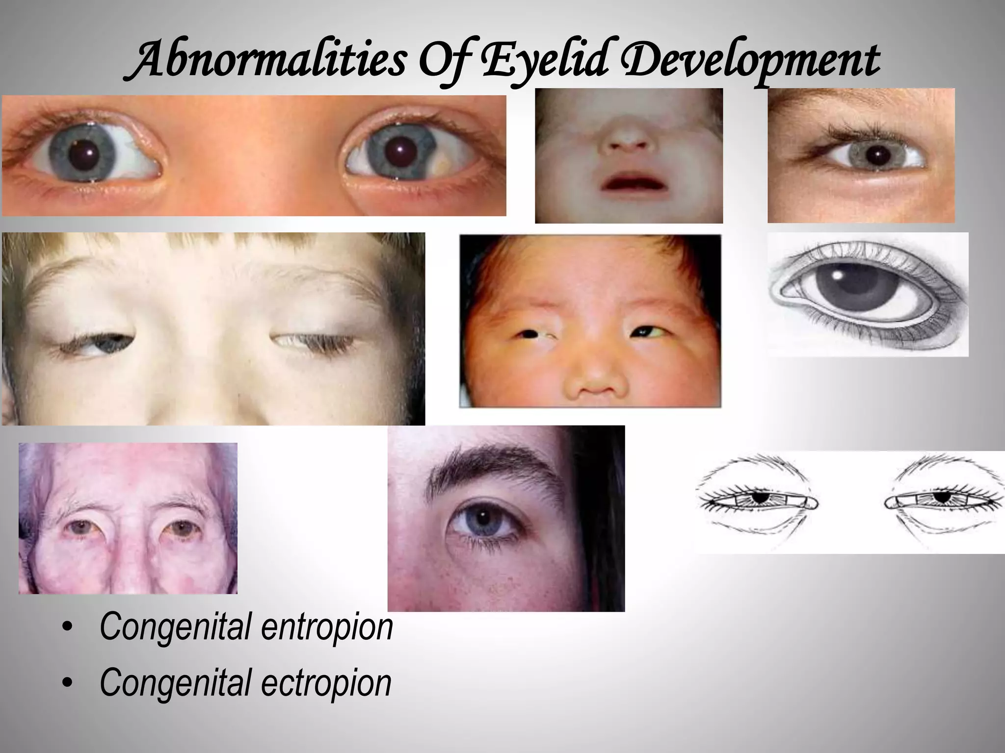 Eye lid anatomy | PPTX