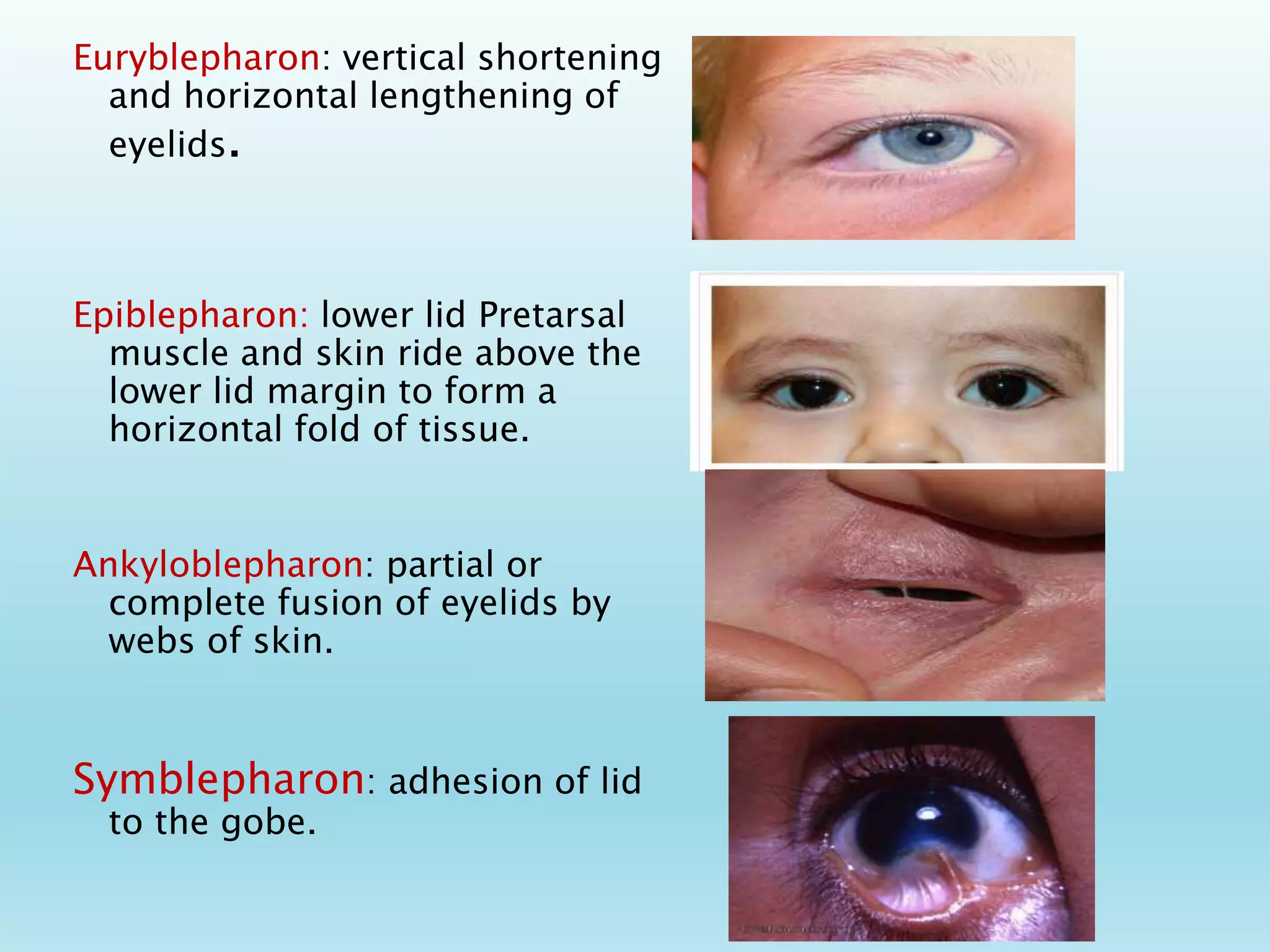Eyelid Anatomy-2.pptx