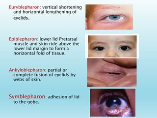 Eyelid Anatomy-2.pptx
