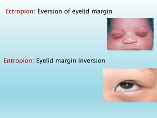 Eyelid Anatomy.pptx