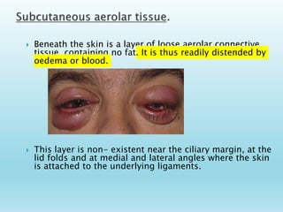 Eyelid Anatomy.pptx