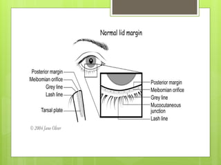 EYE LID ANATOMY AND LACRIMAL SYSTEM.pptx