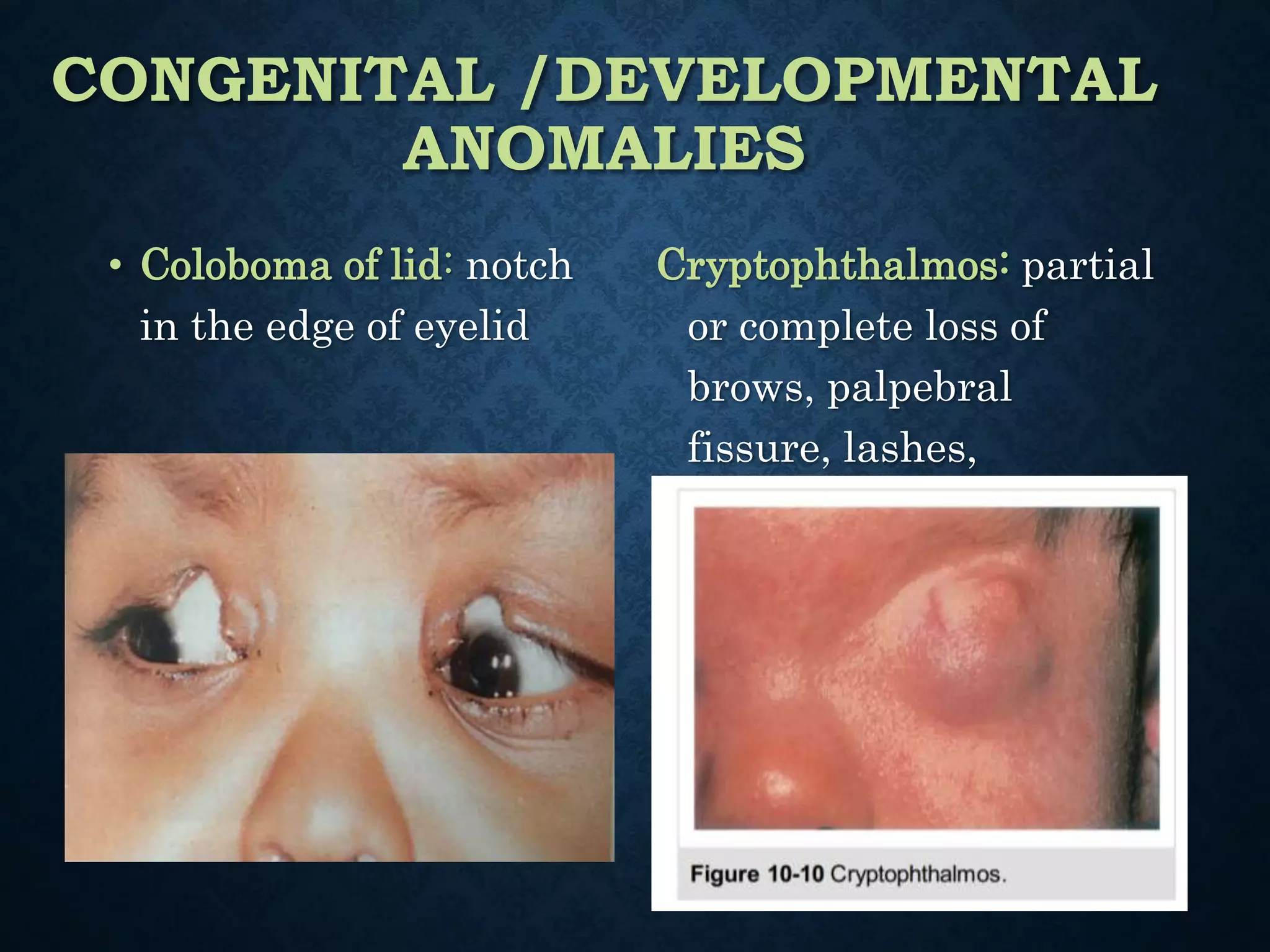 Eyelid anatomy and physiology | PPTX