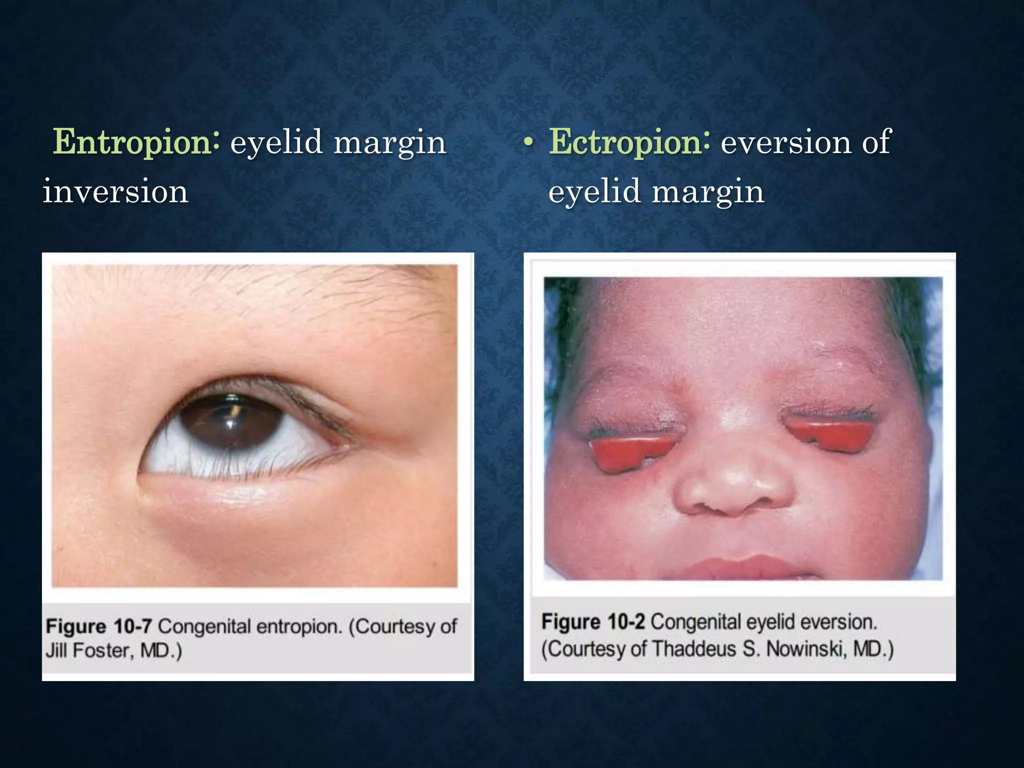 Eyelid anatomy and physiology | PPTX