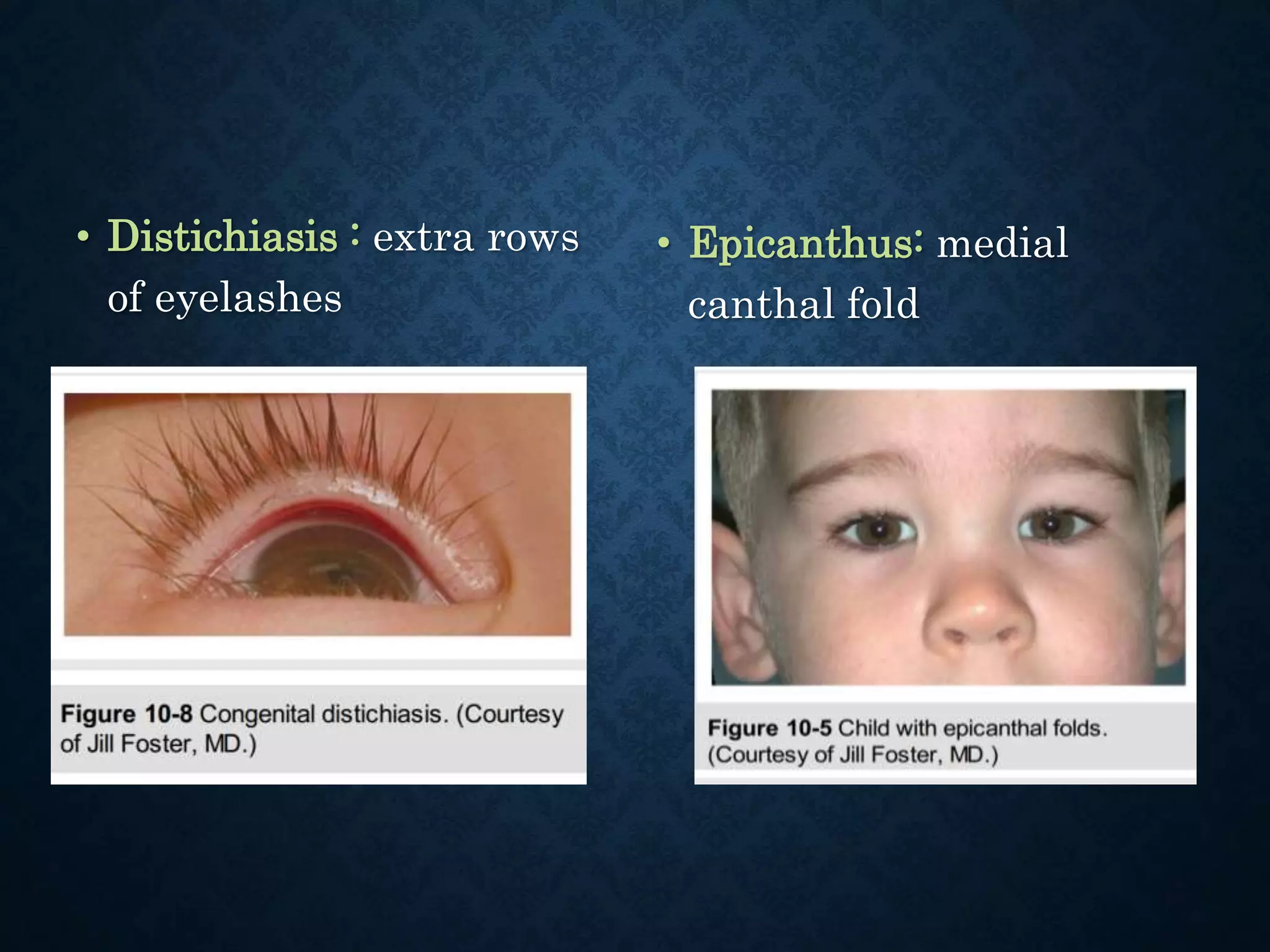 Eyelid anatomy and physiology | PPTX
