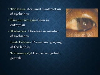 Eyelid anatomy and physiology | PPTX