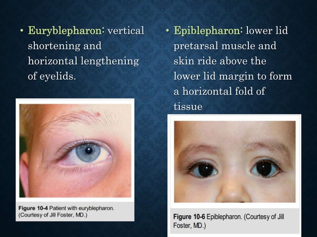 Eyelid anatomy and physiology | PPTX