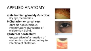 EYELID ANATOMY AND PHYSIOLOGY AND APPLIED.pptx