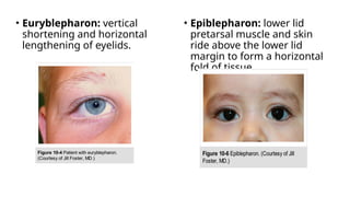 EYELID ANATOMY AND PHYSIOLOGY AND APPLIED.pptx
