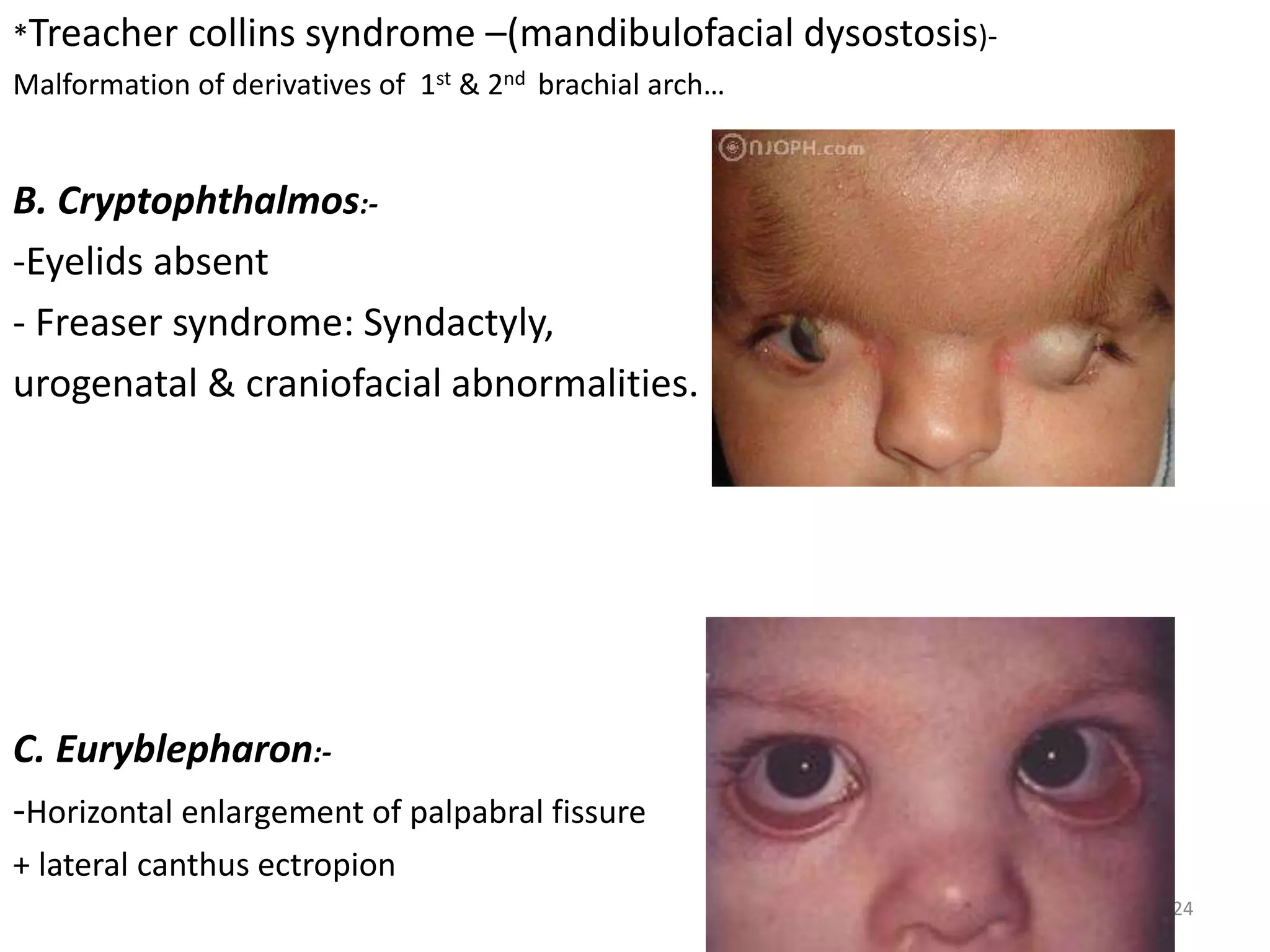 Eyelid anatomy & lacrimal pump physiology | PPTX