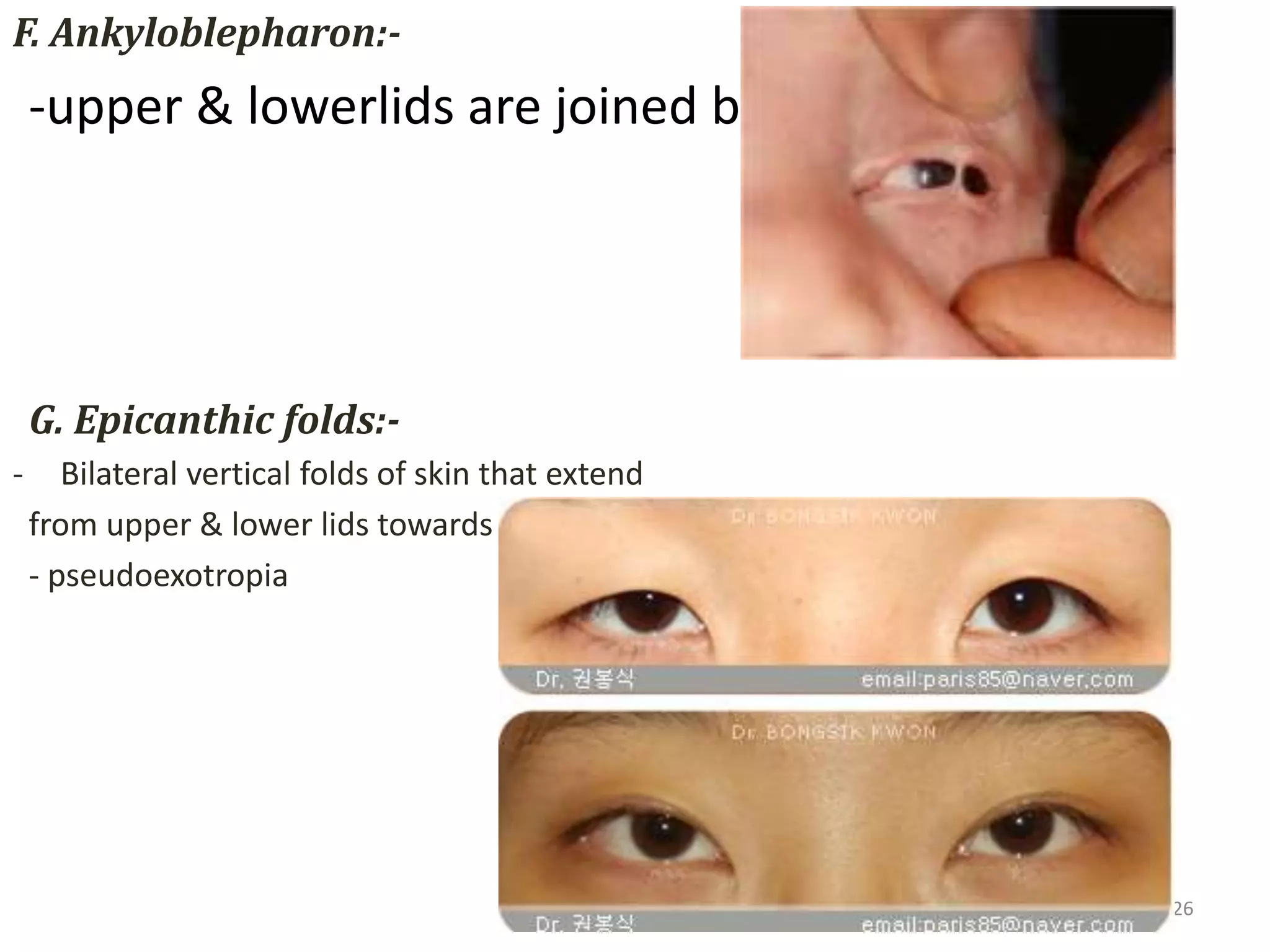 Eyelid anatomy & lacrimal pump physiology | PPTX