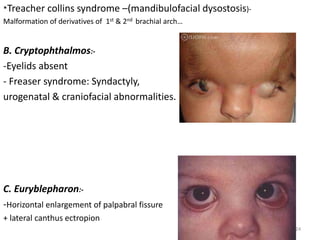 Eyelid anatomy & lacrimal pump physiology | PPTX