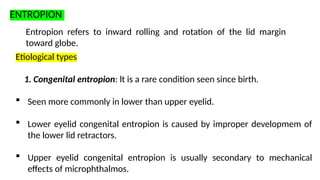 Anomalies in the position of lid margins .pptx