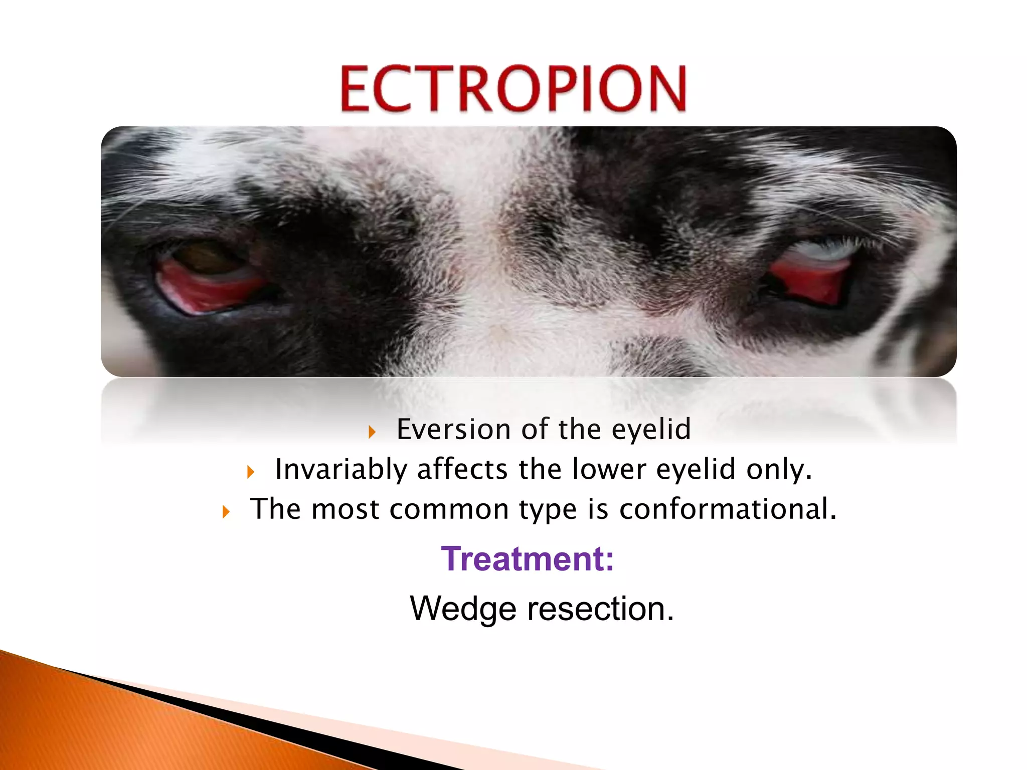 Eyelid disease | PPTX