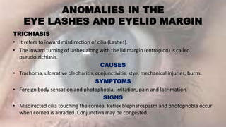 Diseases of eyelid.pptx