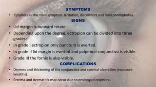 Diseases of eyelid.pptx