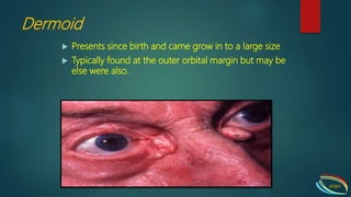 Disorders of eyelids | PPTX