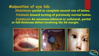 Disorders of eyelids | PPTX
