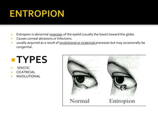 Eye lid disorders | PPTX