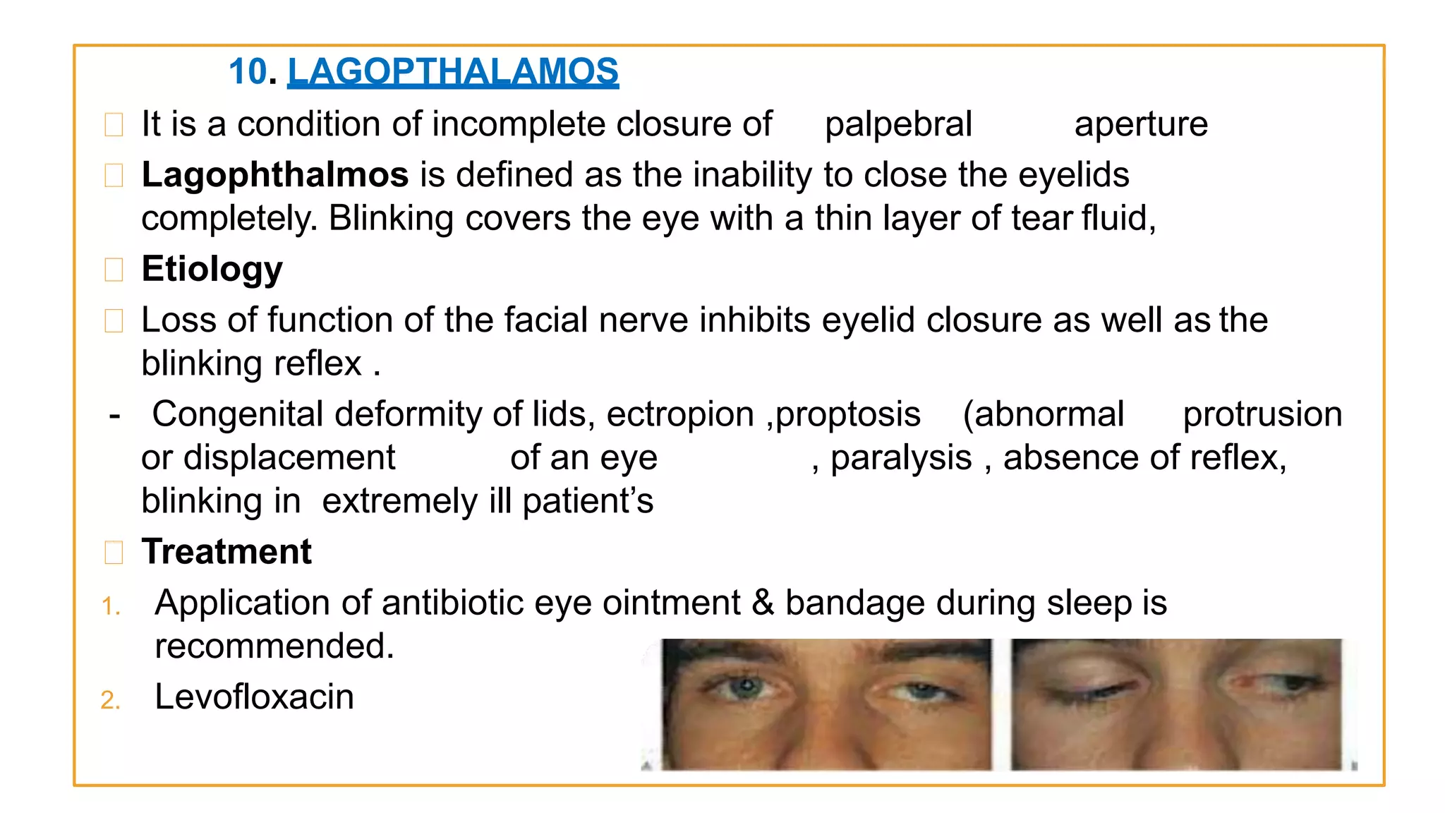 Eyelid disorders | PPTX