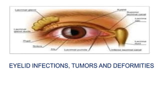 Eyelid disorders | PPTX