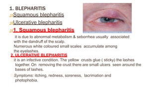 Squamous Blepharitis