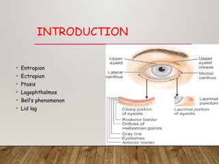 eyelid disorders.pptx various disorders of Lid | PPTX