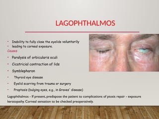 eyelid disorders.pptx various disorders of Lid | PPTX