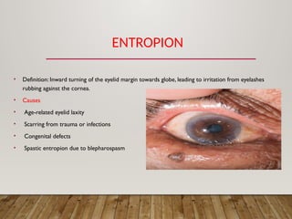 eyelid disorders.pptx various disorders of Lid | PPTX