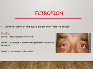 eyelid disorders ophthalmology toxicology .pptx