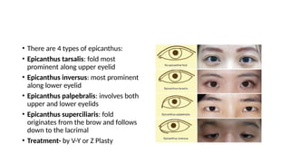 eyelid disorders and tumors - DIAGNOSIS AND MANAGEMENT | PPTX