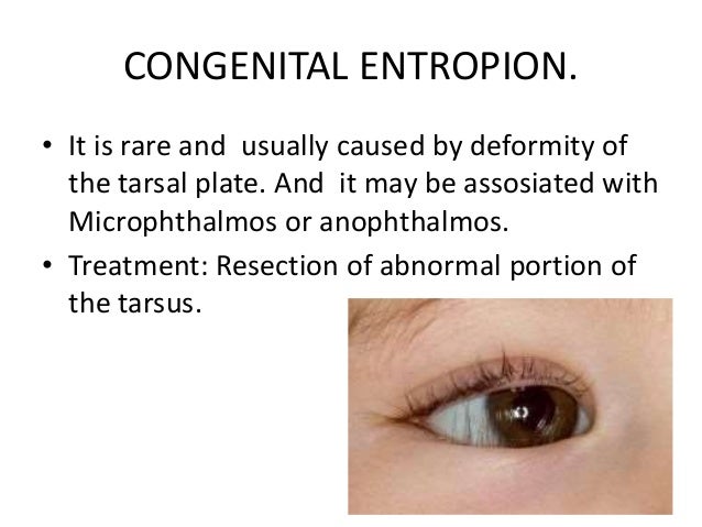 Eye lid i & ii 10.08.16