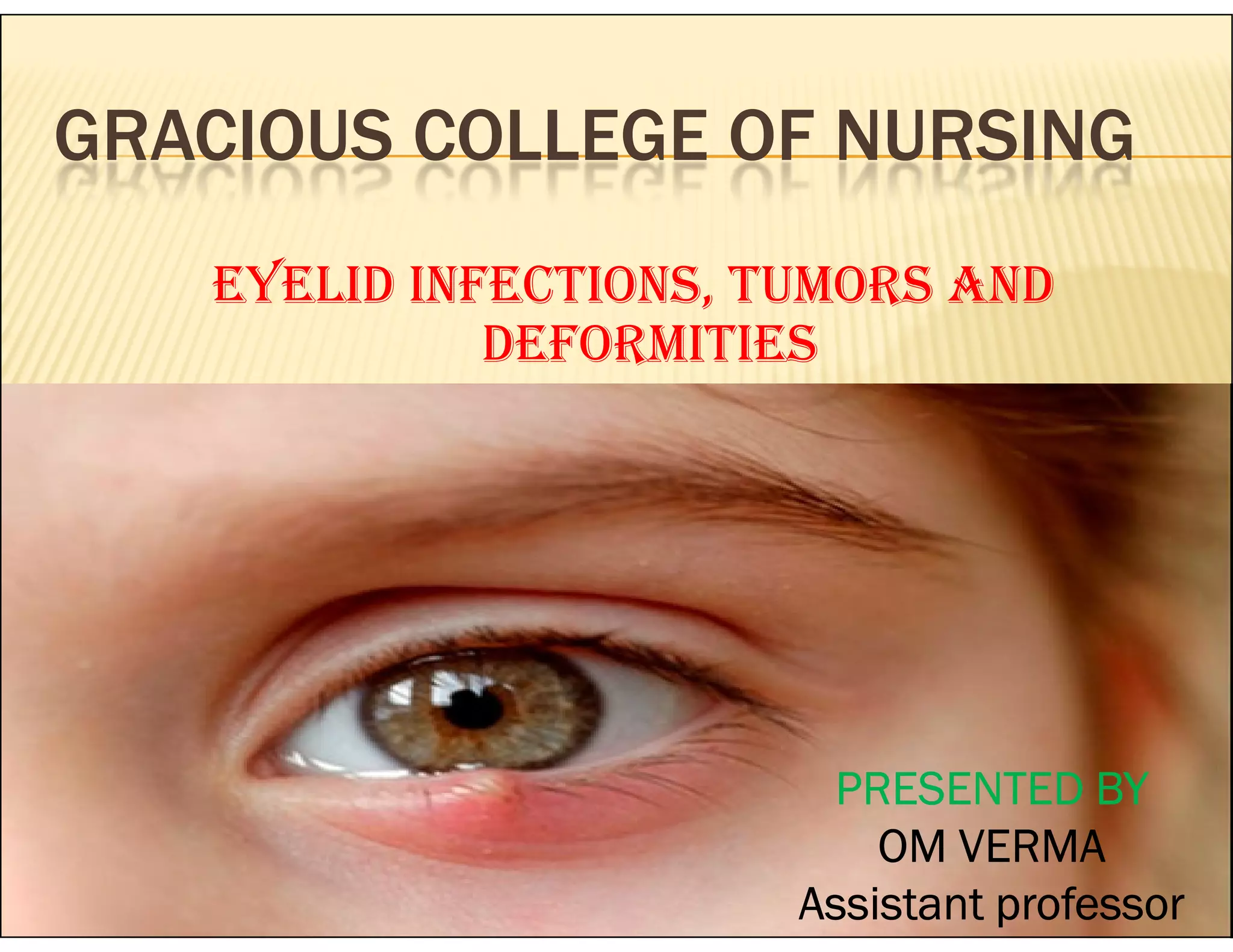 eyelid infection OM VERMA 2023.pdf