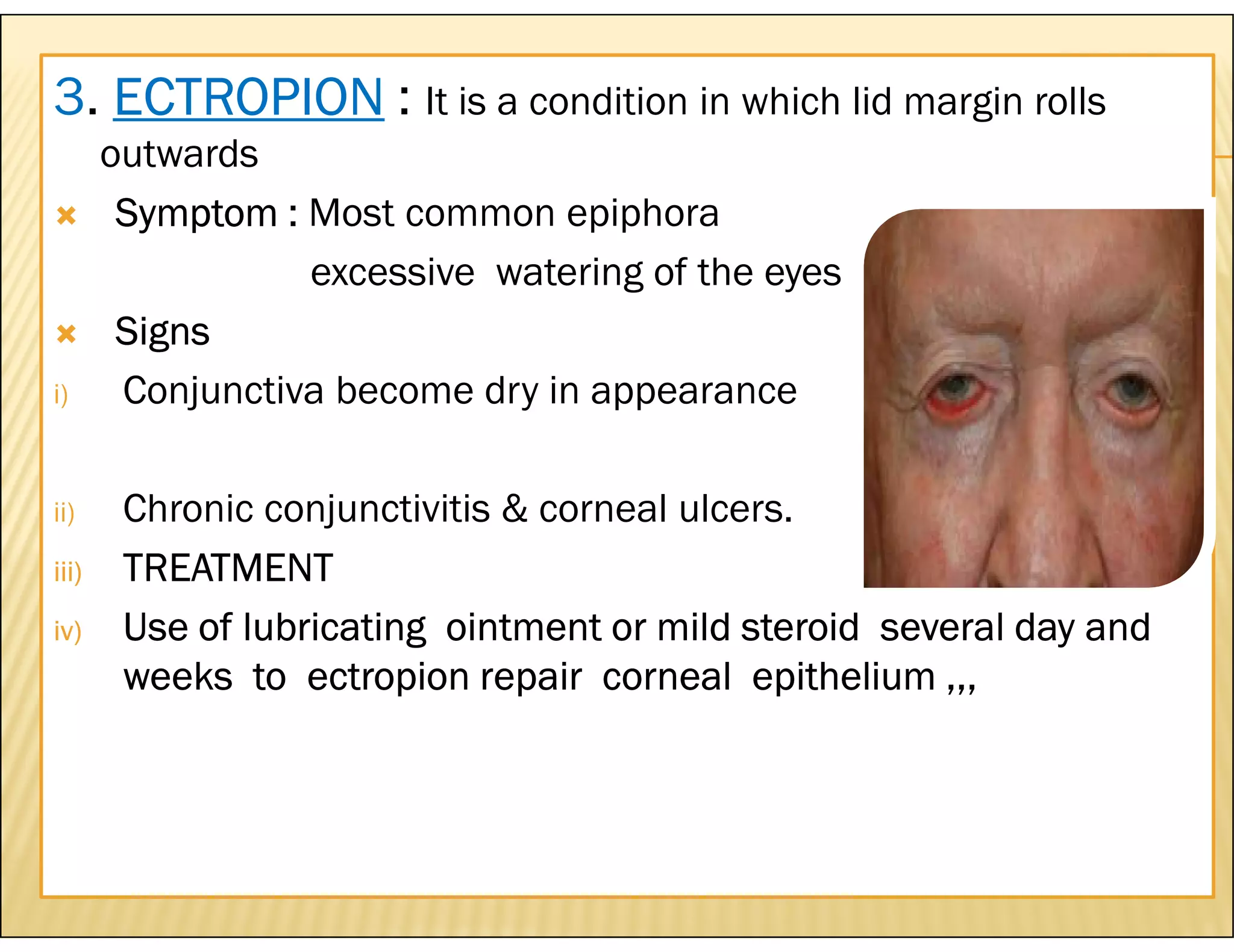 eyelid infection OM VERMA 2023.pdf