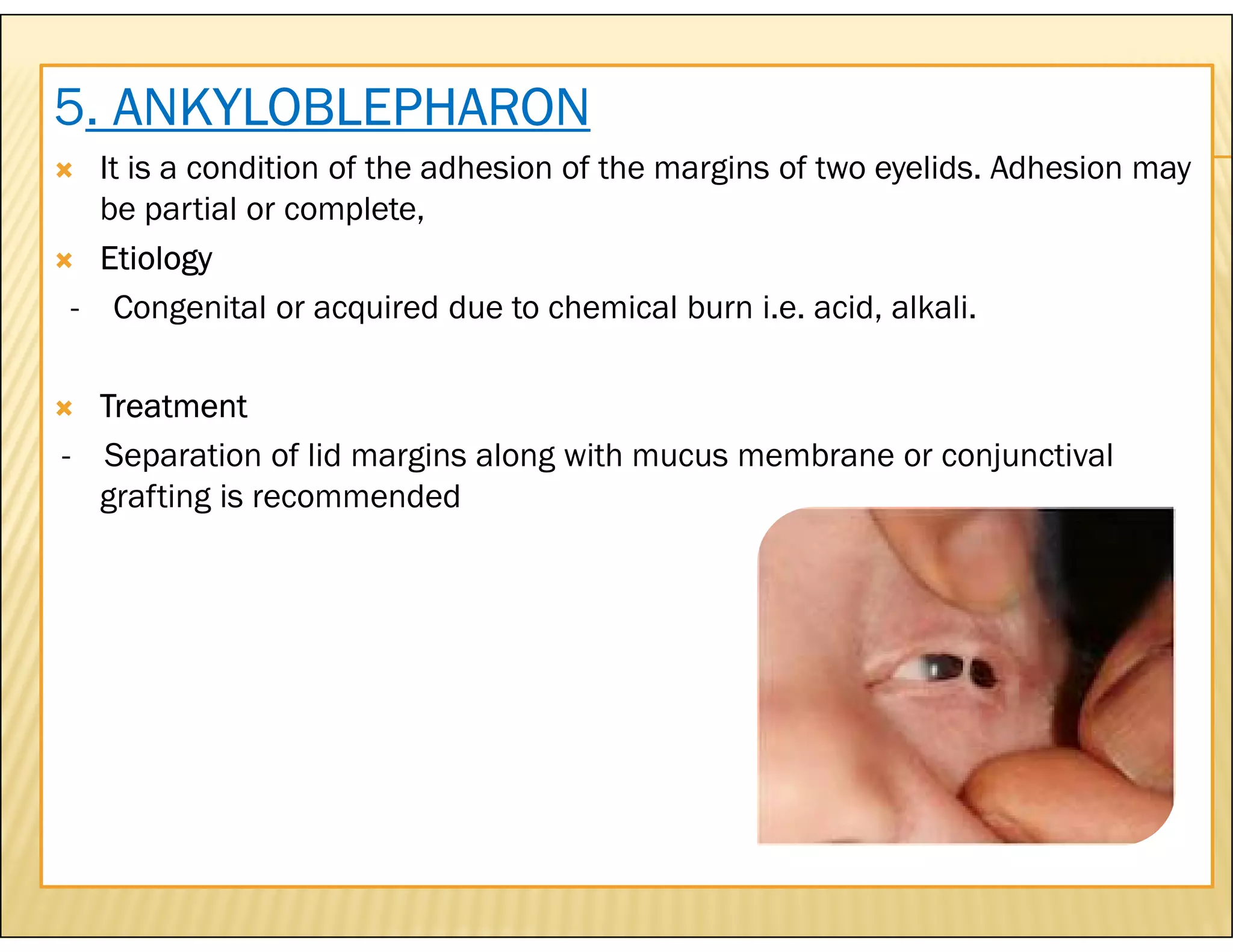 eyelid infection OM VERMA 2023.pdf