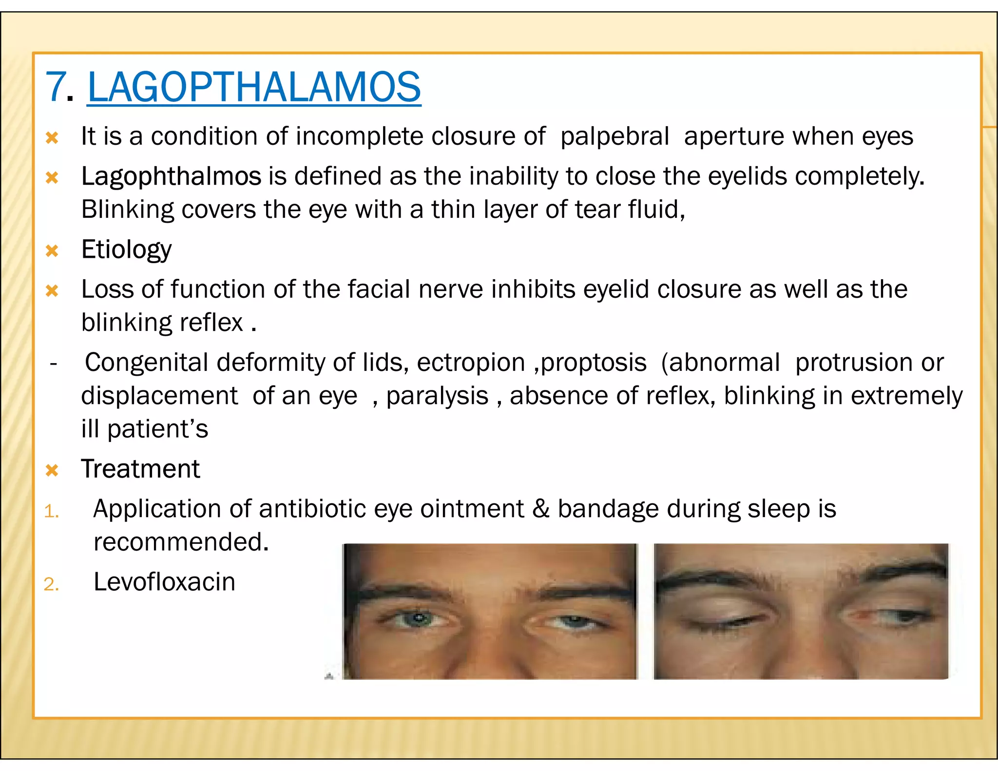 eyelid infection OM VERMA 2023.pdf
