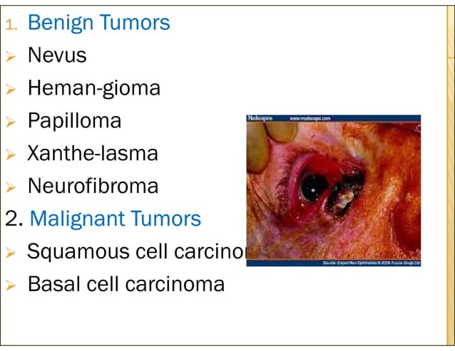 eyelid infection OM VERMA 2023.pdf