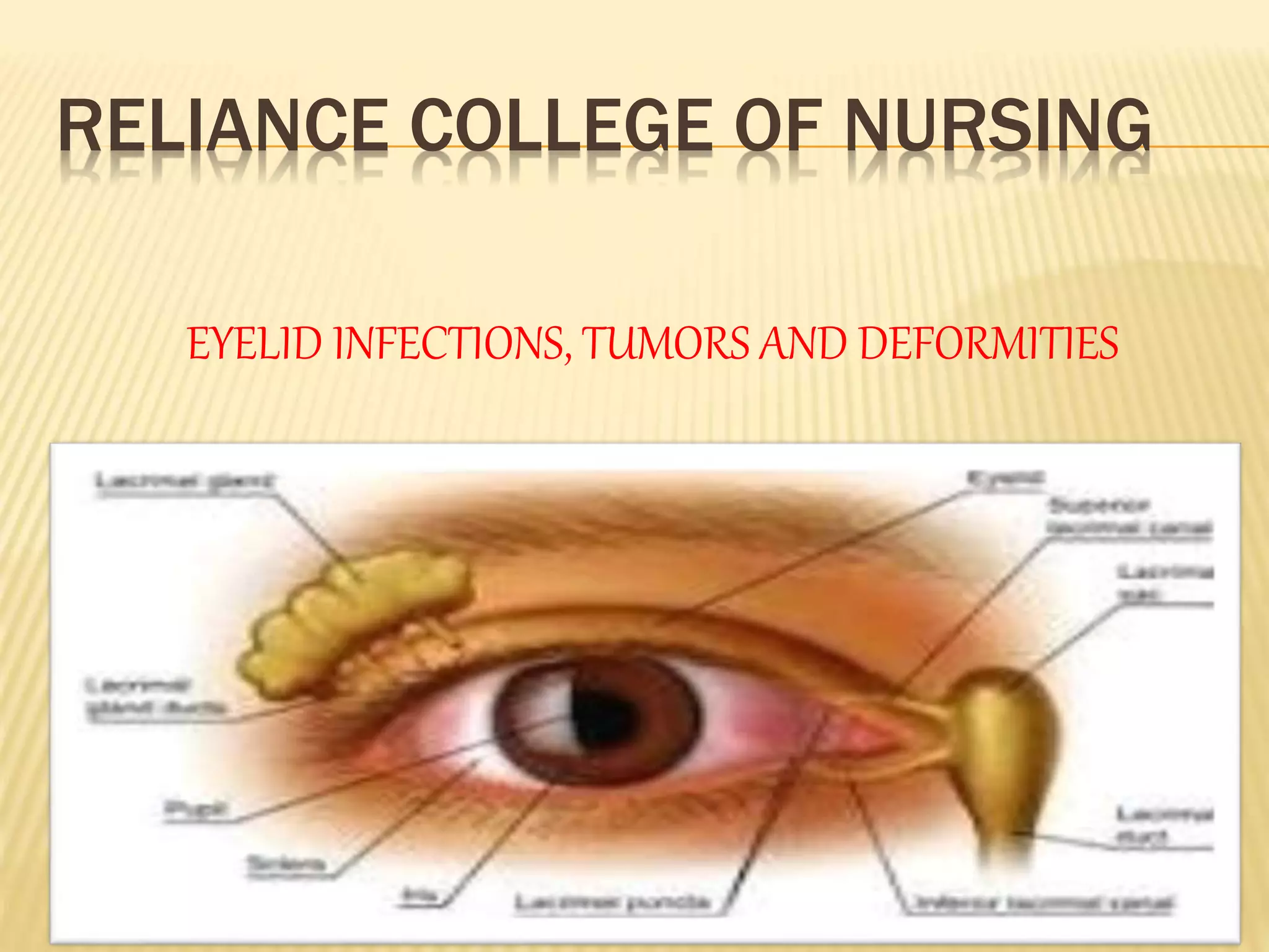 Eyelid infections ppt | PPTX