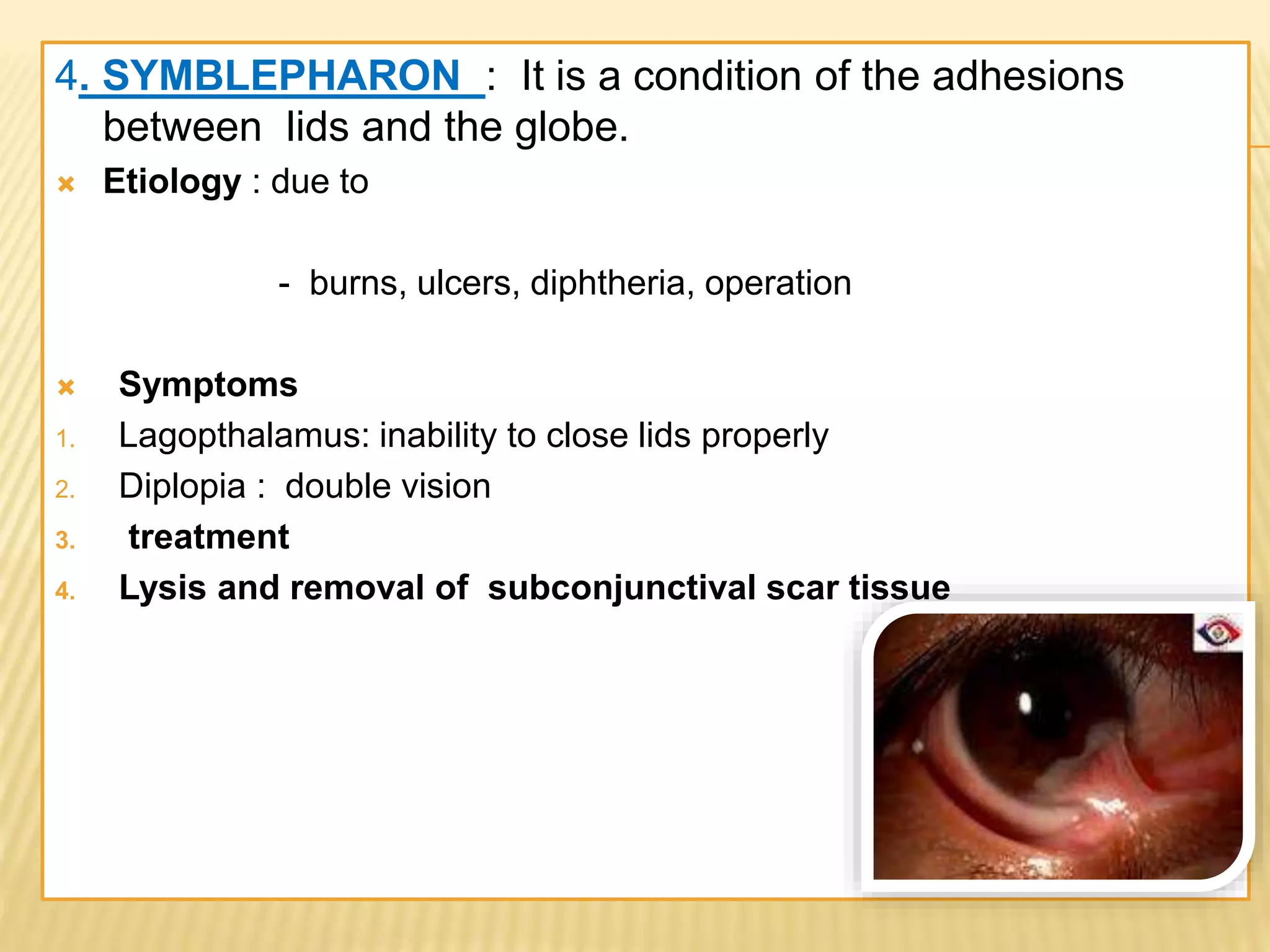 Eyelid infections ppt | PPTX
