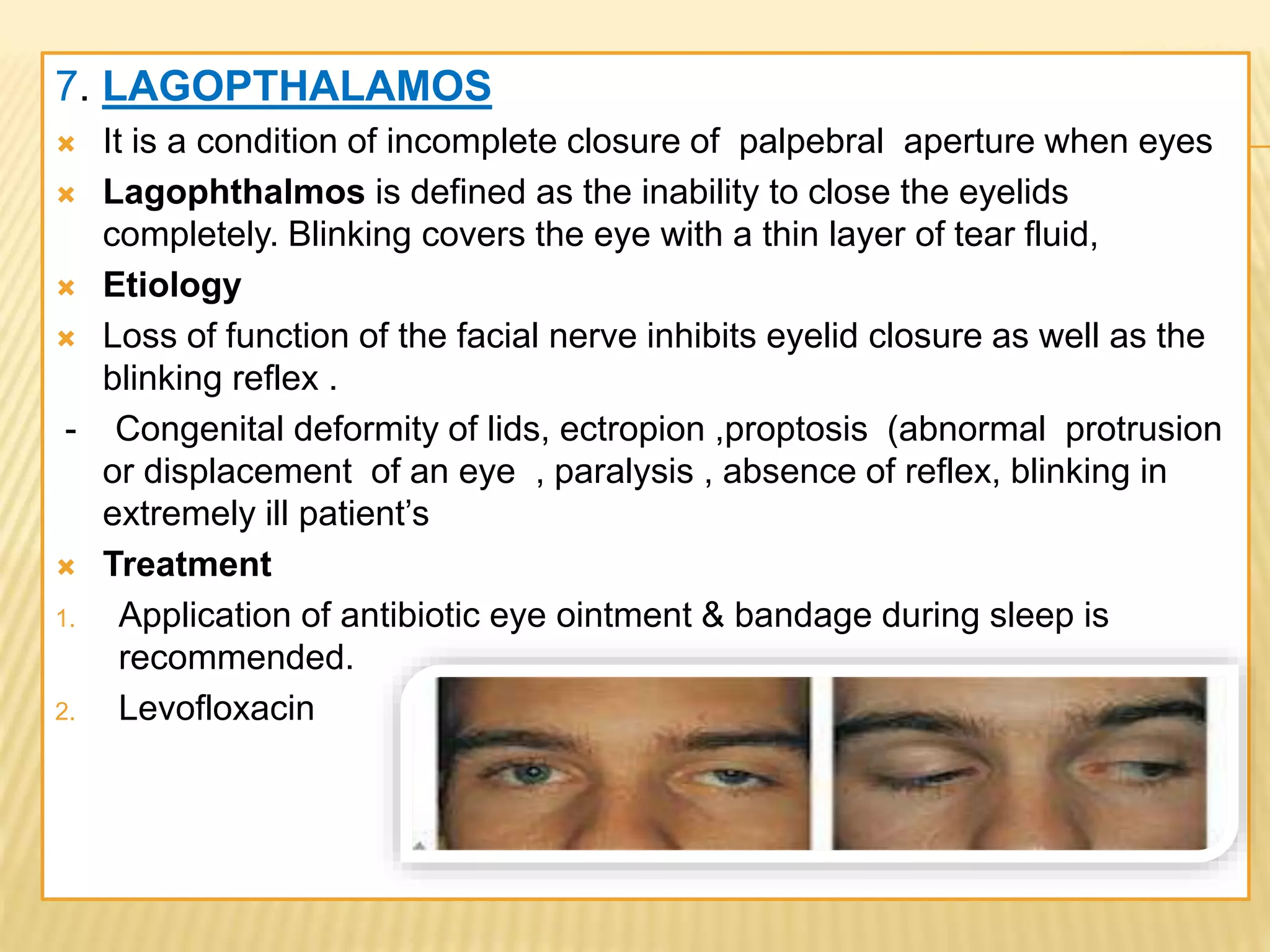 Eyelid infections ppt | PPTX