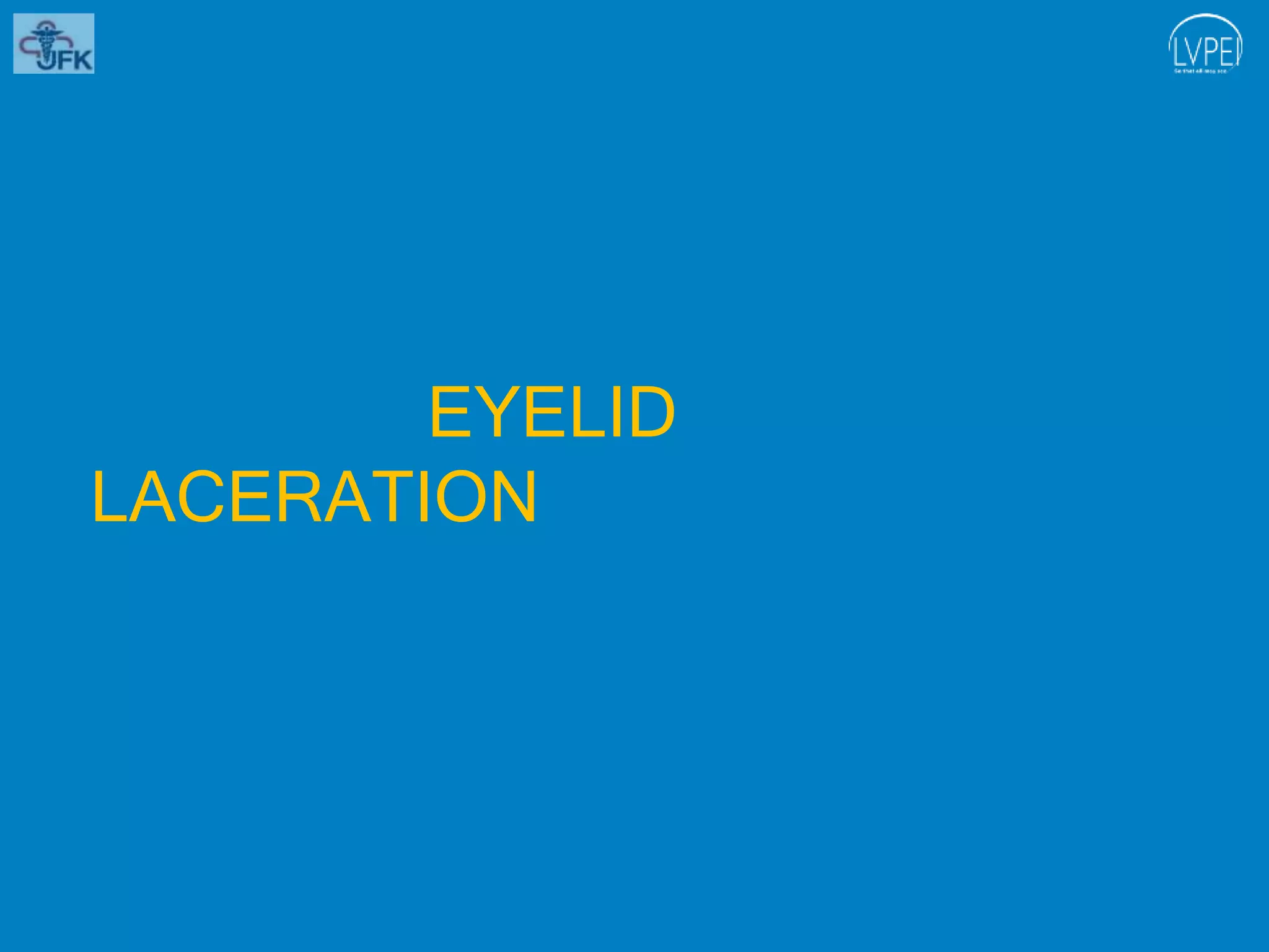 Eyelid laceration repair with defects.pptx