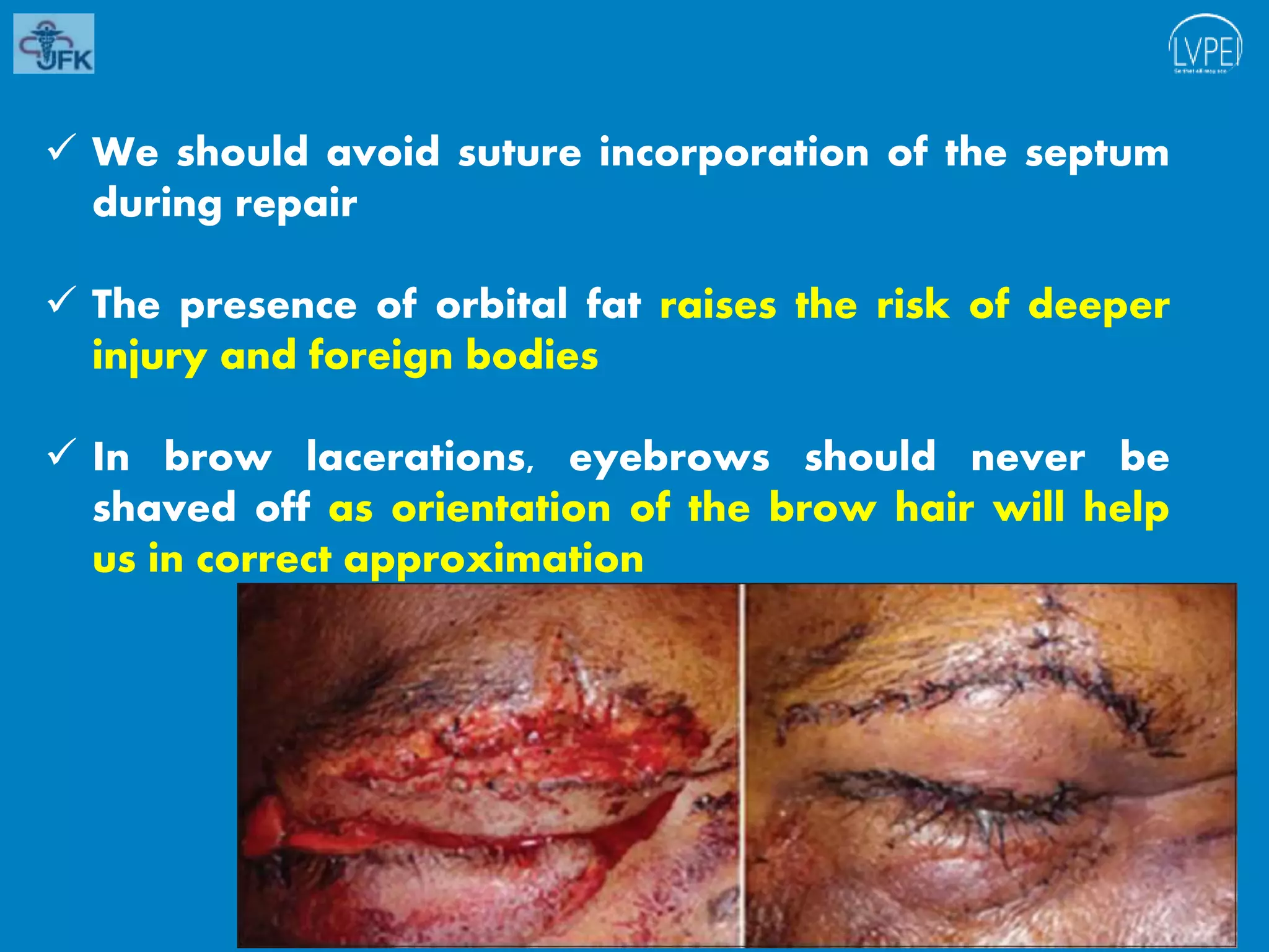 Eyelid laceration repair with defects.pptx