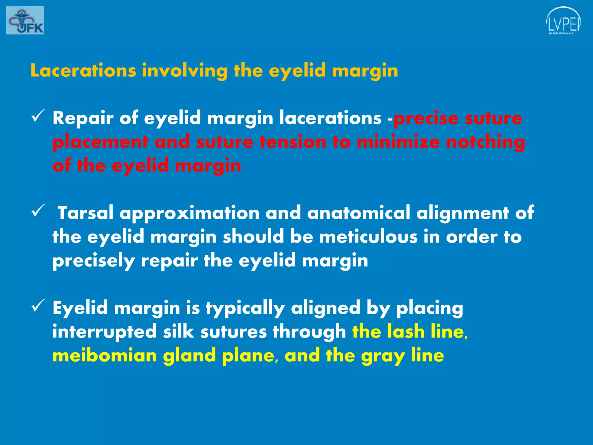 Eyelid laceration repair with defects.pptx
