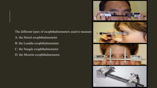 Eyelid, Lacrimal System, and Orbital Examination (1).pptx
