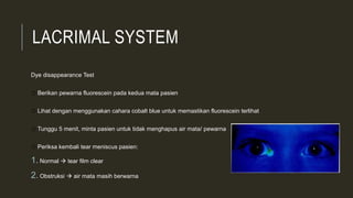 Eyelid, Lacrimal System, and Orbital Examination (1).pptx