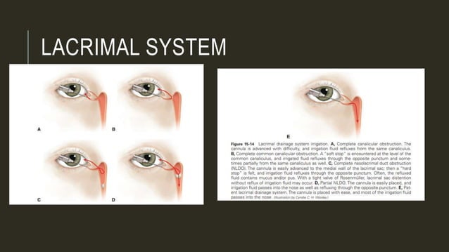 Eyelid, Lacrimal System, and Orbital Examination (1).pptx