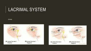 Eyelid, Lacrimal System, and Orbital Examination (1).pptx